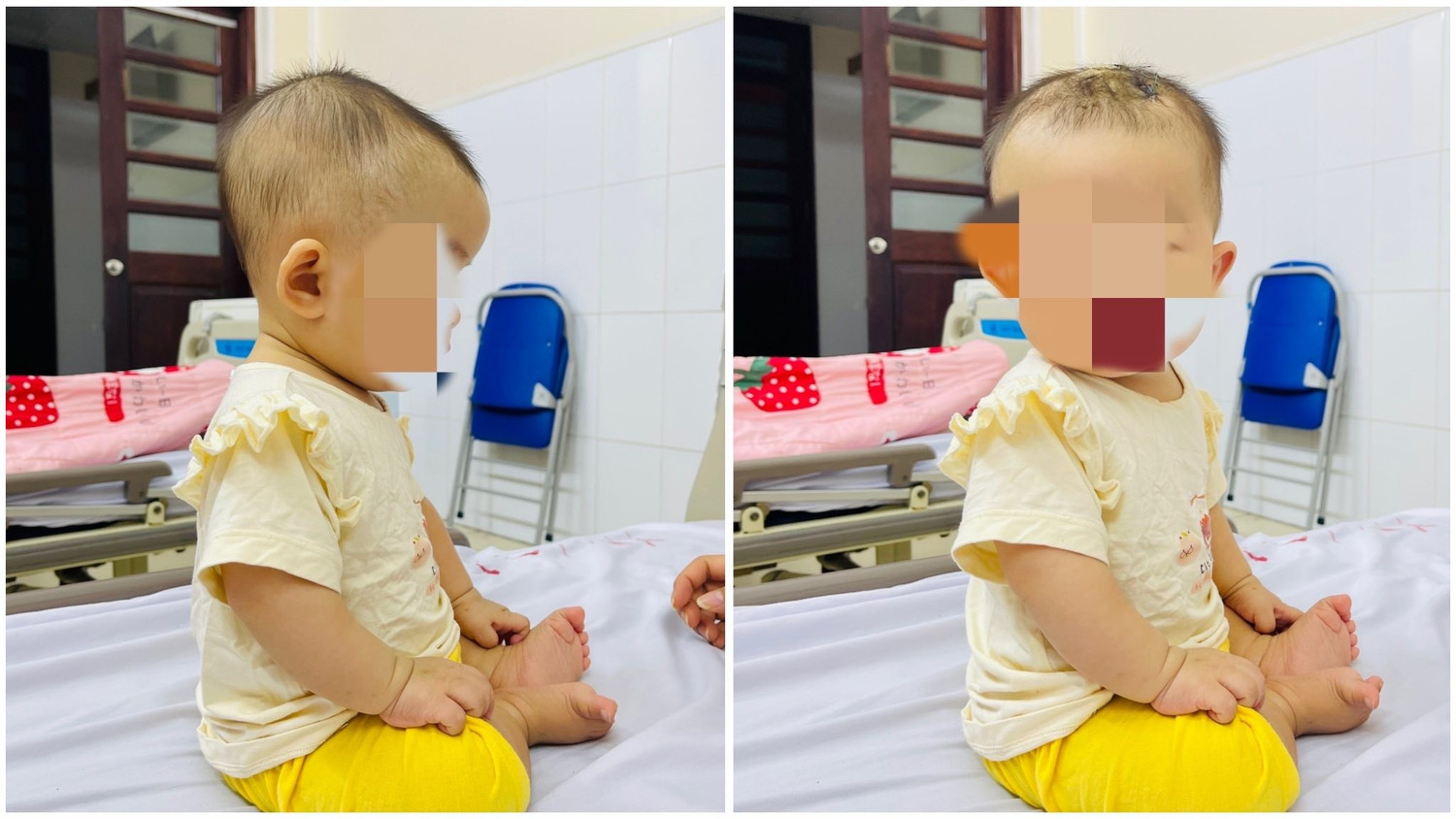 1 tuần sau ngã giường bé 7 tháng tuổi nguy kịch vì máu tụ | Báo Tri thức và Cuộc sống - TIN TỨC ...