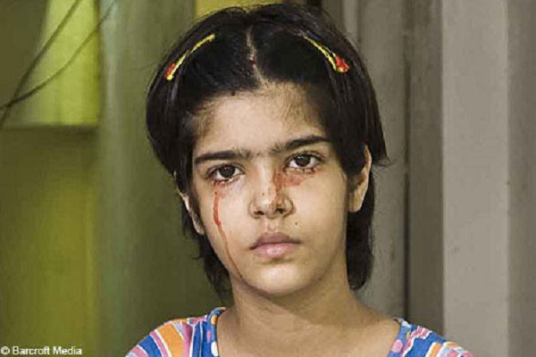 Khóc ra đá và loạt căn bệnh hiếm gặp thách thức y học | Báo Tri thức và ...