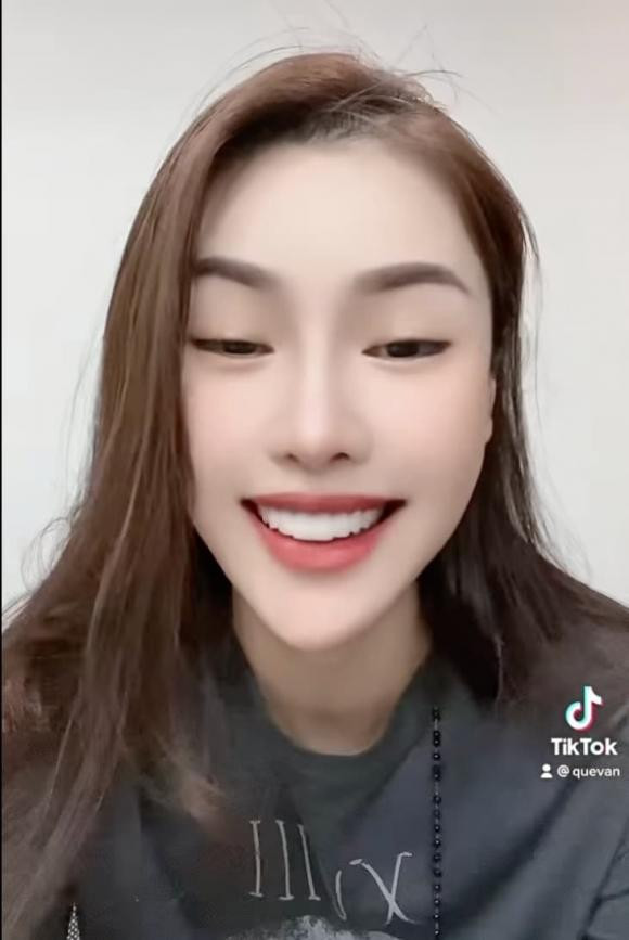 Quế Vân rụng răng sứ trông "dở khóc dở cười" | Báo Tri thức và Cuộc ...